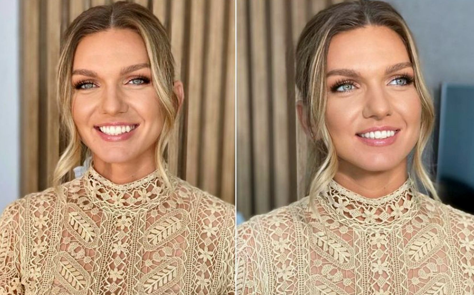 Cum arată Simona Halep la o săptămână de la operația la nas: "Mereu ...